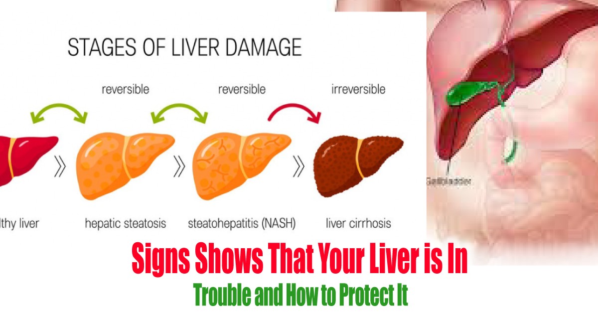 Signs Shows That Your Liver is In Trouble and How to Protect It ...